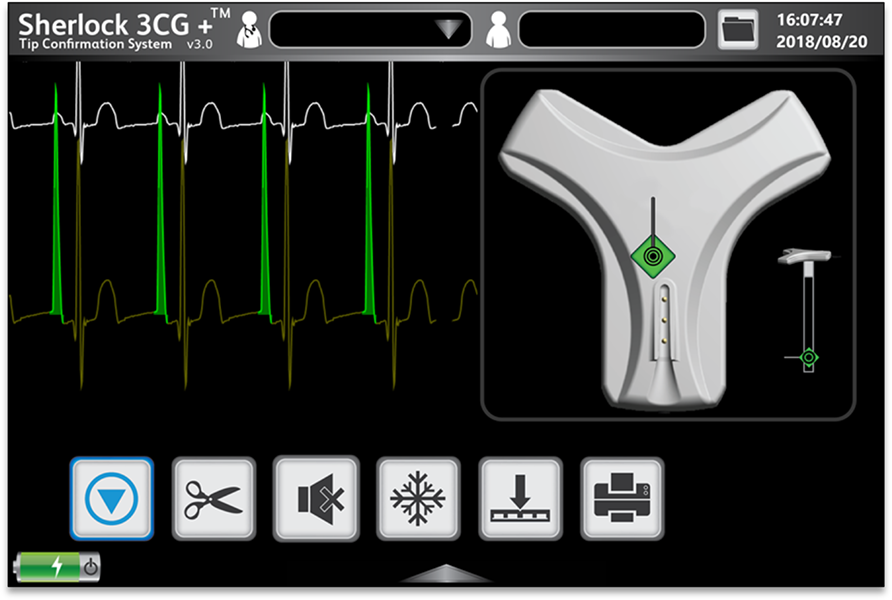 シャーロック3CGプラス™ PICC 留置用ナビゲーションシステム | BD